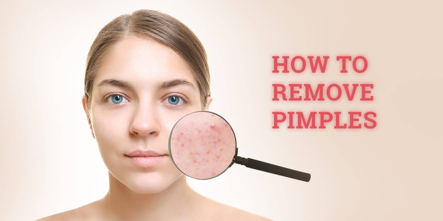 Effective Tips to Get Rid of Pimples and Pimple Marks