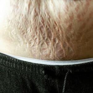 Realistic Postpartum Body Images For Most Women Contrary What Instagram ...