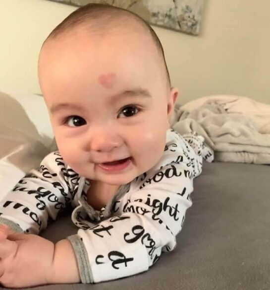 People With Rare Features That Make Them Unique