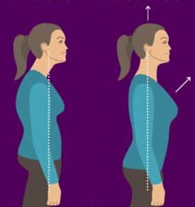 Neck Hump Exercises That Will Save Your Posture