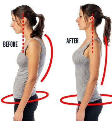 Neck Hump Exercises That Will Save Your Posture