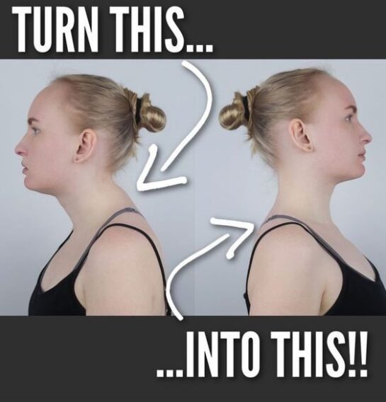 Neck Hump Exercises That Will Save Your Posture