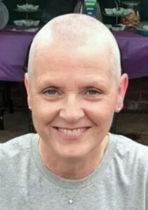 Rock a Bold Bald Hairstyle and Embrace Your Baldness