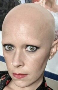 Rock a Bold Bald Hairstyle and Embrace Your Baldness