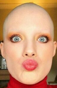 Rock a Bold Bald Hairstyle and Embrace Your Baldness