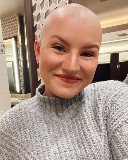 Rock a Bold Bald Hairstyle and Embrace Your Baldness