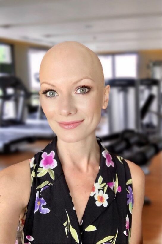 Rock a Bold Bald Hairstyle and Embrace Your Baldness