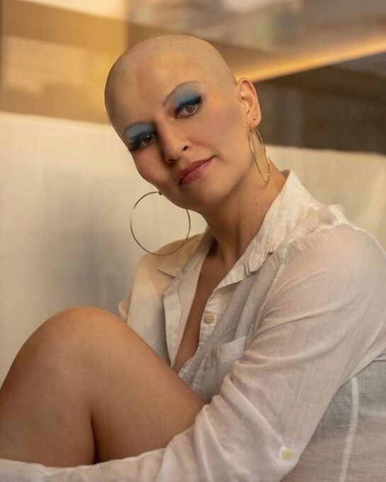 Rock a Bold Bald Hairstyle and Embrace Your Baldness