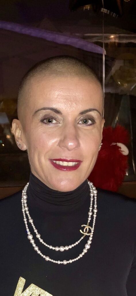 Rock a Bold Bald Hairstyle and Embrace Your Baldness