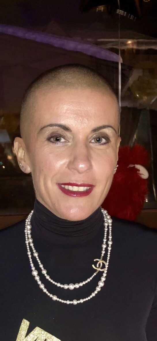 Rock a Bold Bald Hairstyle and Embrace Your Baldness