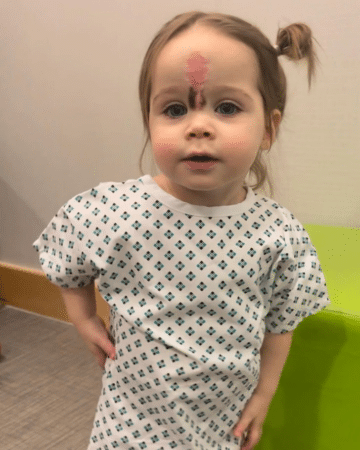 Parents Sent Daughter To Surgery To Remove Rare Birthmark