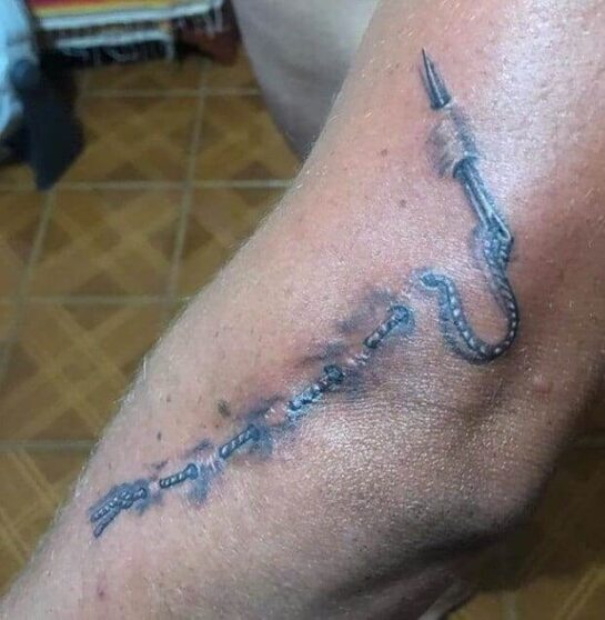 How to Make Scars and Birthmarks into Art