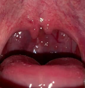 How To Share Body Features That Make Your Beauty Shine