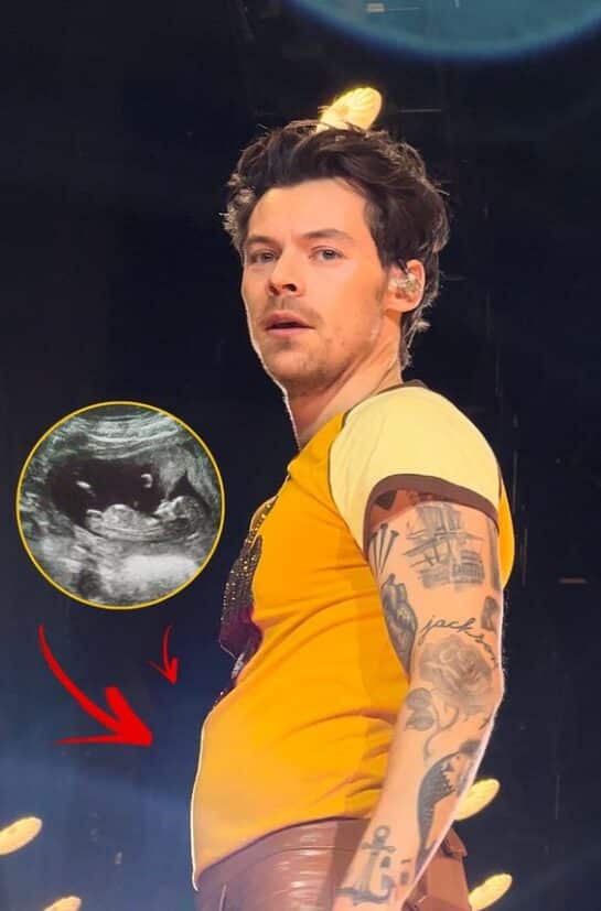 Get Ready to Laugh Hard The Funniest Harry Styles Pictures Ever!